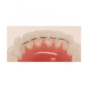 Retainers Wire - IBDAA